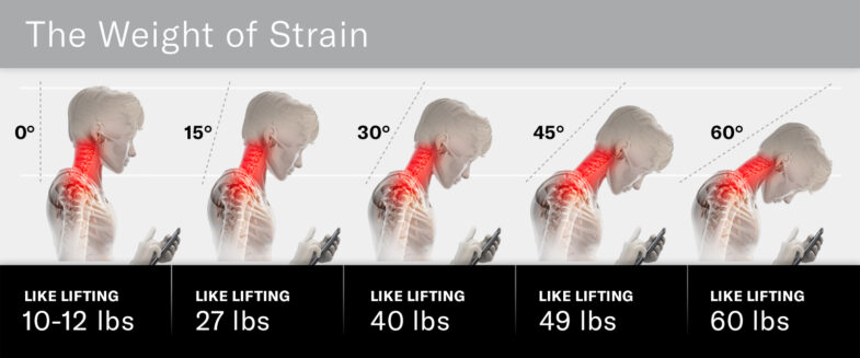 Tips to prevent and fix ‘tech neck’ and pain from technology use