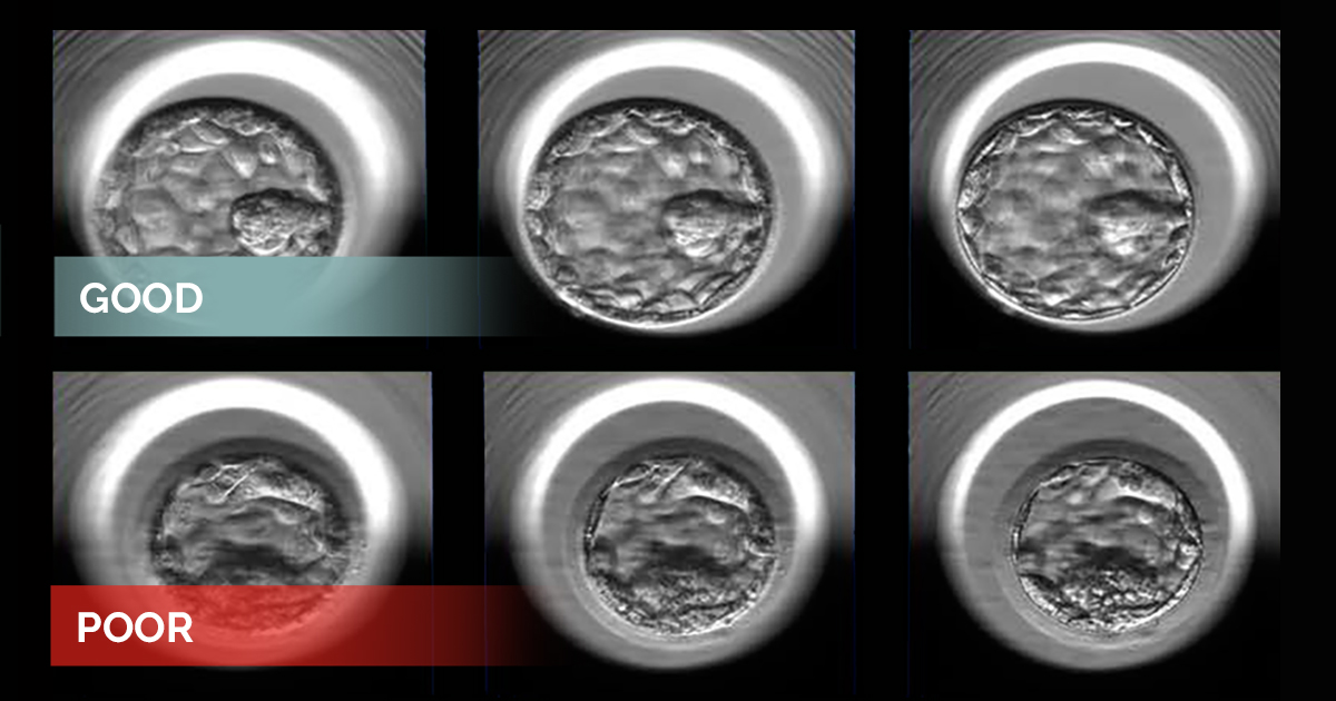 How Artificial Intelligence Could Improve The Odds Of IVF