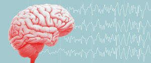 What to Know About Epilepsy