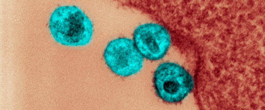 New Treatment Offers Hope for People Living With Drug-Resistant HIV