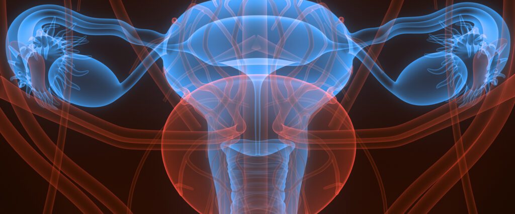 Should You Have Your Fallopian Tubes Removed to Prevent Ovarian Cancer?