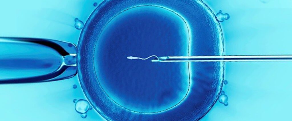 How Does IVF Work?
