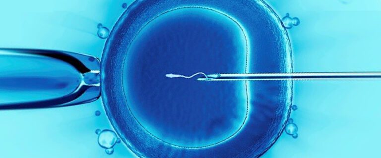 How Does IVF Work?