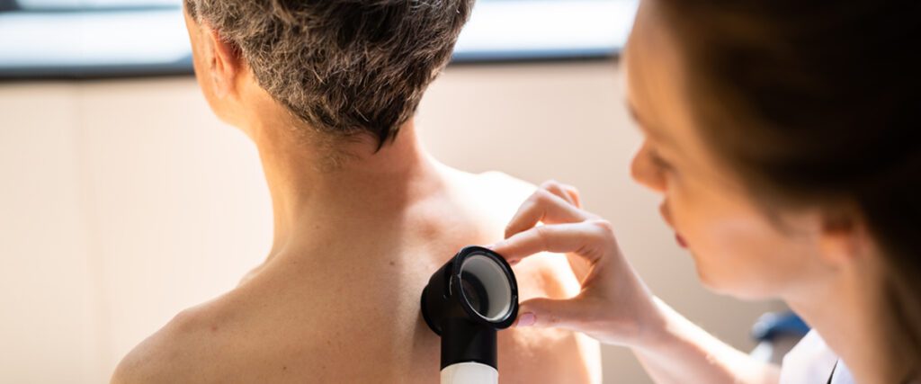 5 Facts About Merkel Cell Carcinoma - NewYork-Presbyterian