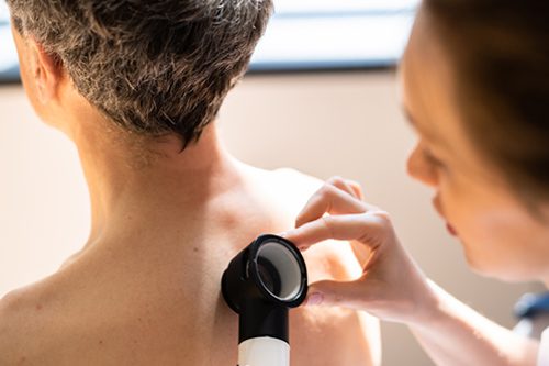 5 Facts About Merkel Cell Carcinoma - NewYork-Presbyterian