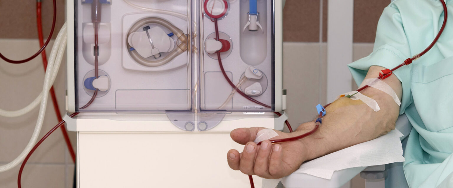 How Does Dialysis Work?