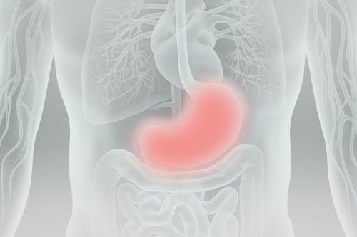 Understanding Stomach Cancer