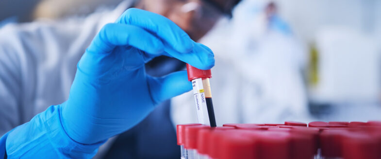 FDA Approves First Blood Test to Detect Colorectal Cancer - GI, Oncology