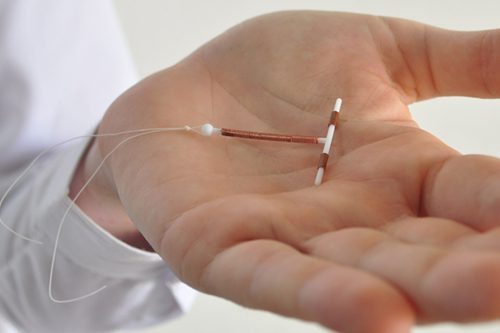 IUD Insertion Pain: What to Expect and How to Prepare