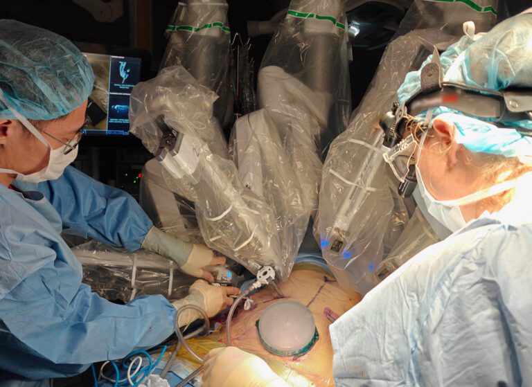 First Fully Robotic Liver Transplant in New York - Hospital ...