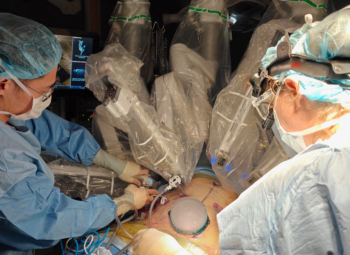 First Fully Robotic Liver Transplant in New York - Hospital ...