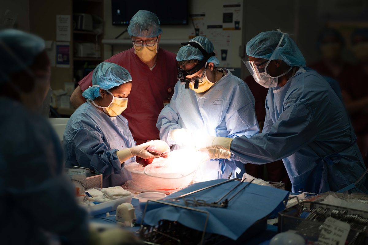 First Domino Split-Liver Transplant in Adults in the United States